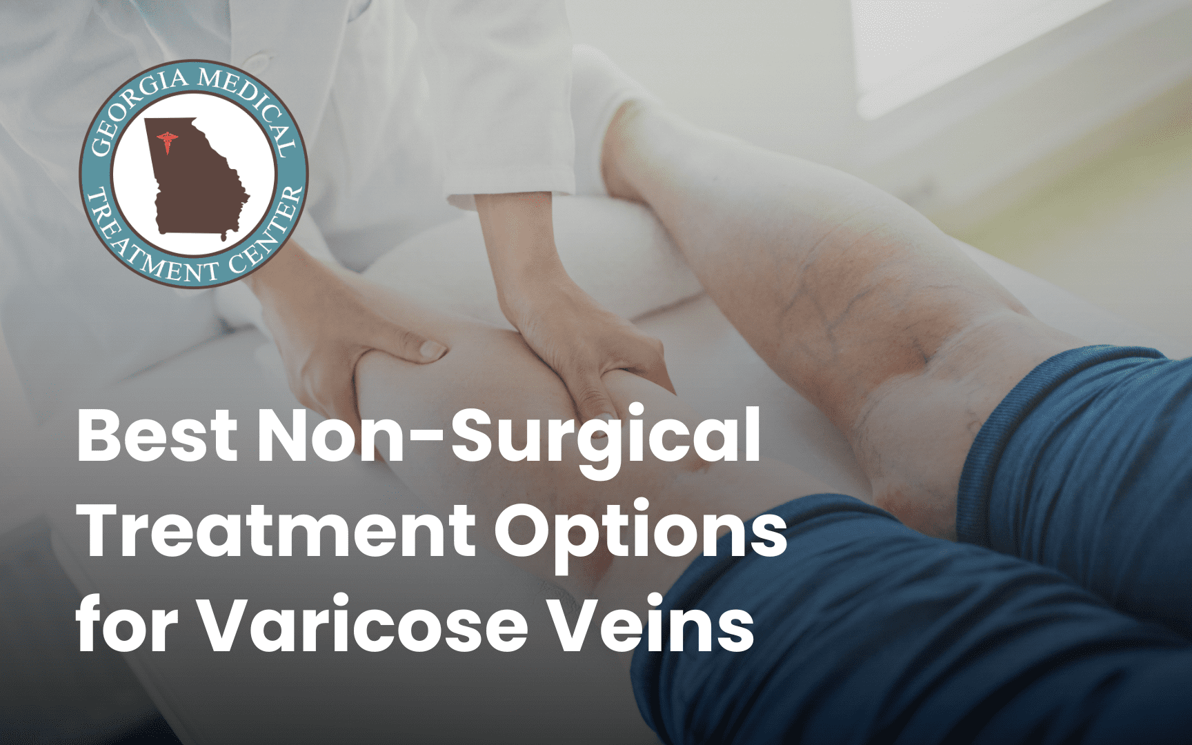 Non-Surgical Treatments for Varicose Veins